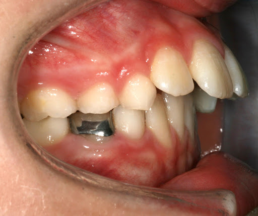 Parent Info - St George Paediatric Dental Specialists