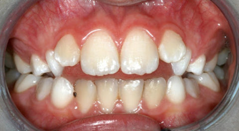 Parent Info - St George Paediatric Dental Specialists